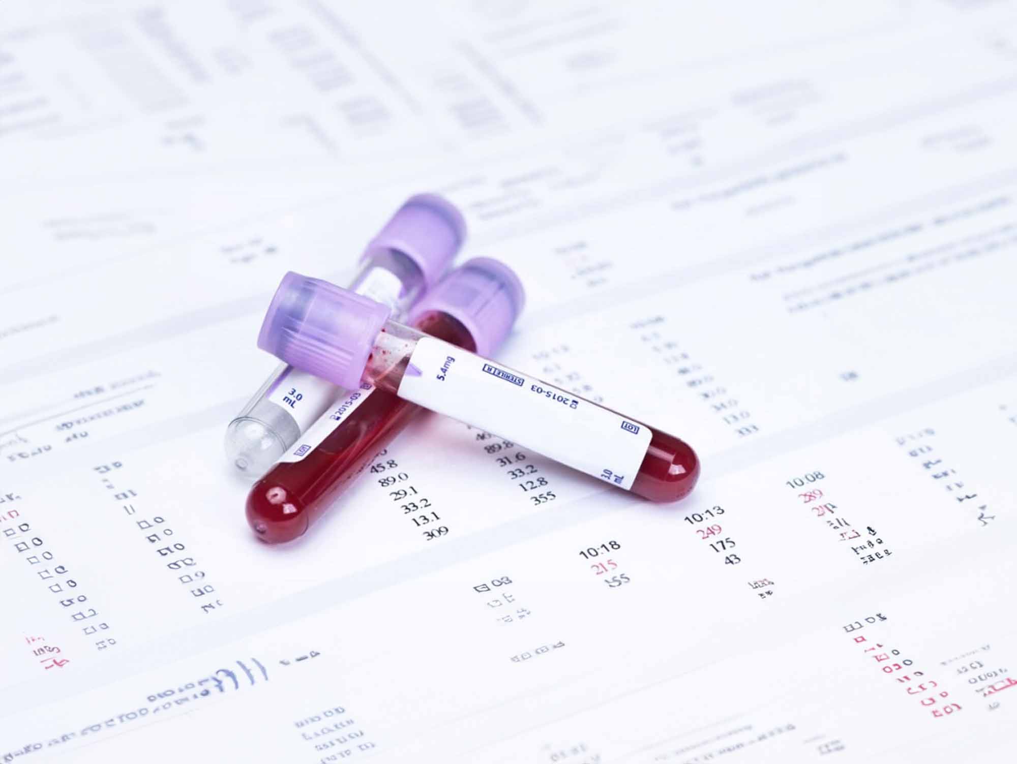 Hemogram: Tam Kan Sayımı (TKS/CBC)